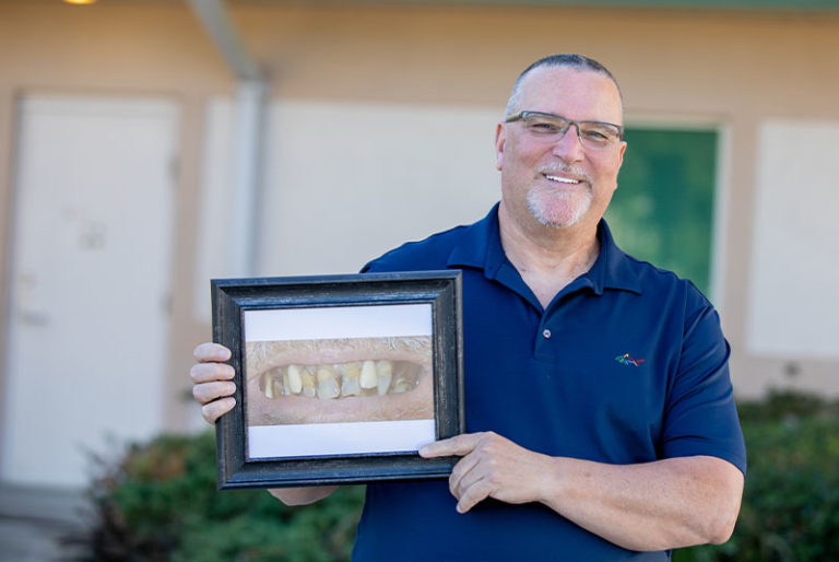 Dental Implants in Spring Hill, FL | Get Teeth in One Day